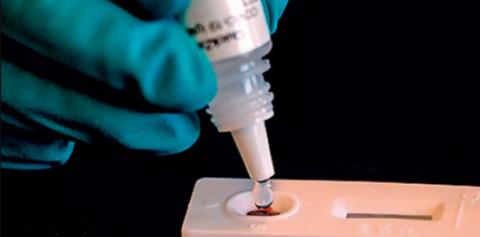 Sri Lanka university gets COVID-19 antibody testing kits | South Asia ...
